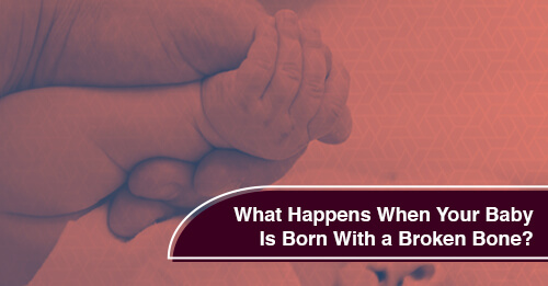 What Happens When Your Baby Is Born With a Broken Bone?